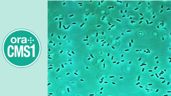 Oral Probiotics inhibit respiratory and intestinal infection viruses ...