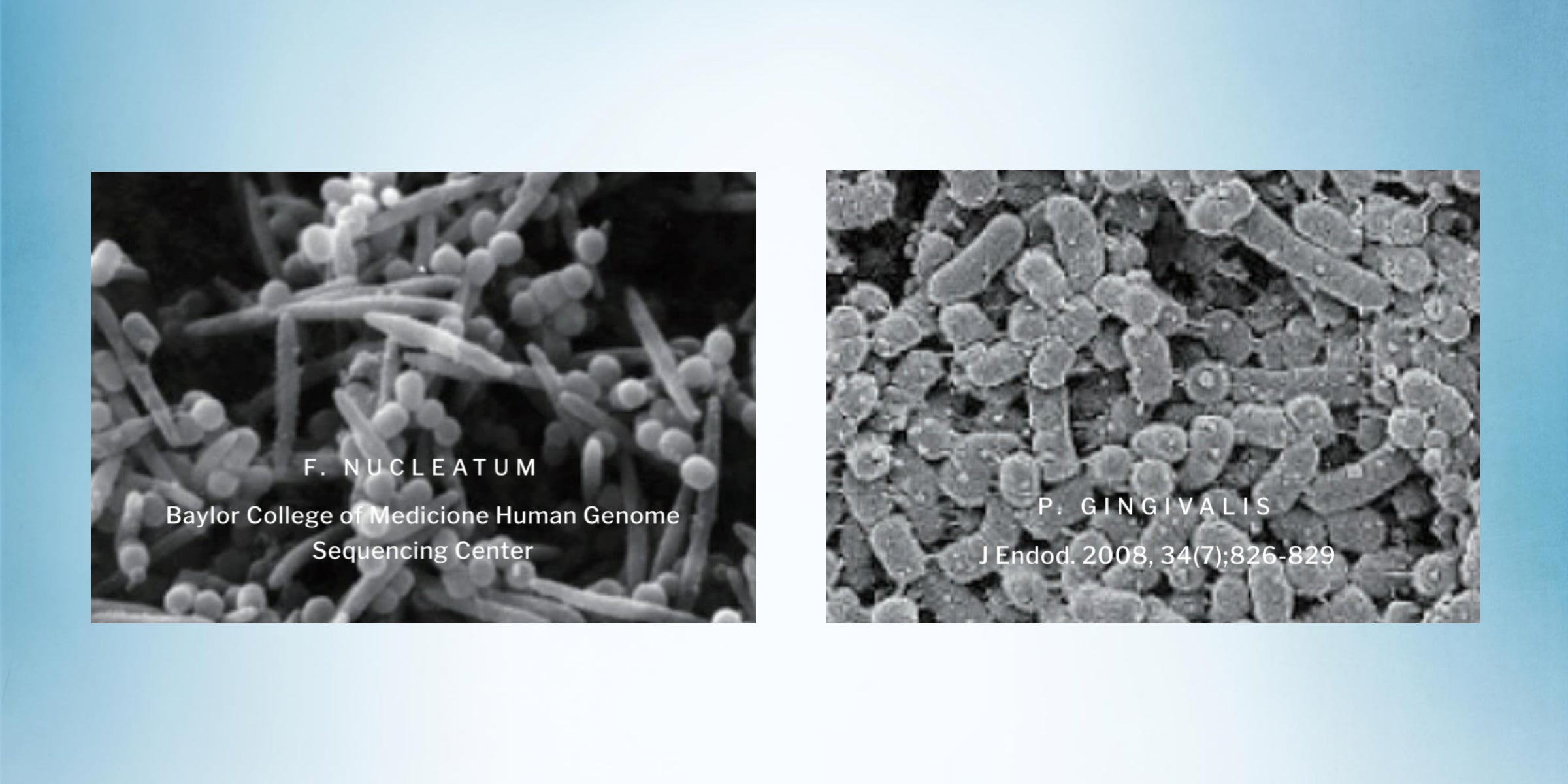 Prominent Harmful Oral Bacteria: F. nucleatum and P. gingivalis – OraTicx